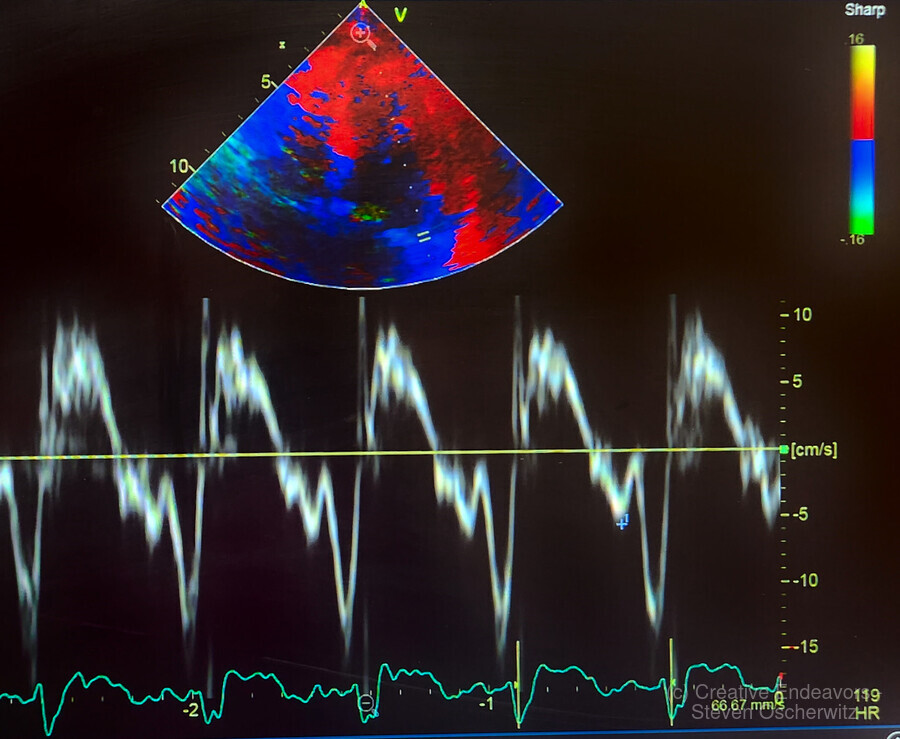 ECHO map and waveforms by Creative Endeavors - Steven Oscherwitz Wall Art