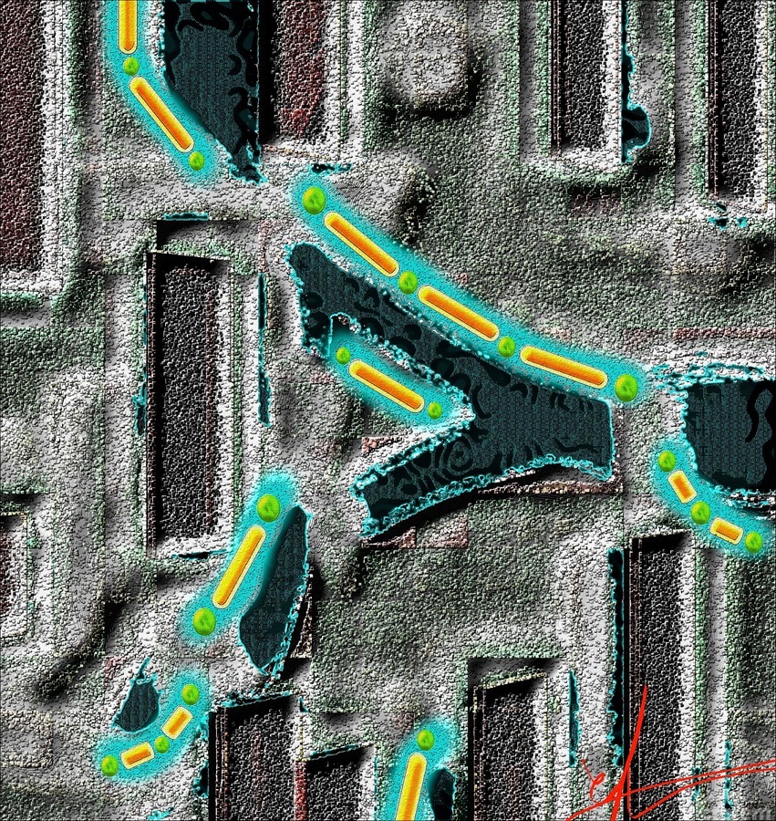 Surgical Wishbone Break by Ed Purchla Wall Art